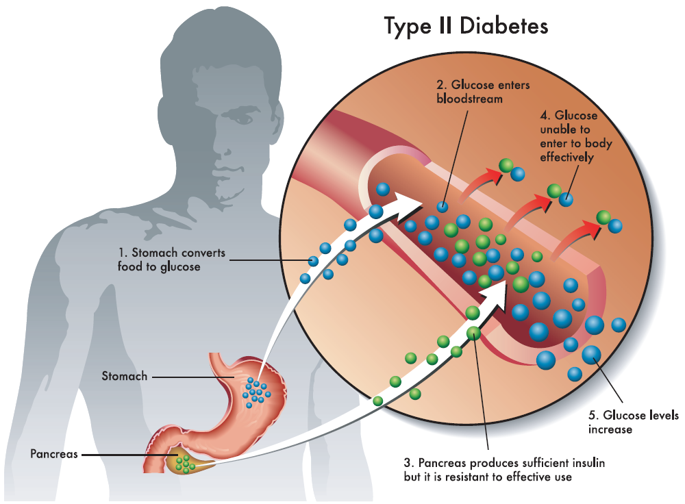 Diabetes Lessons Blendspace